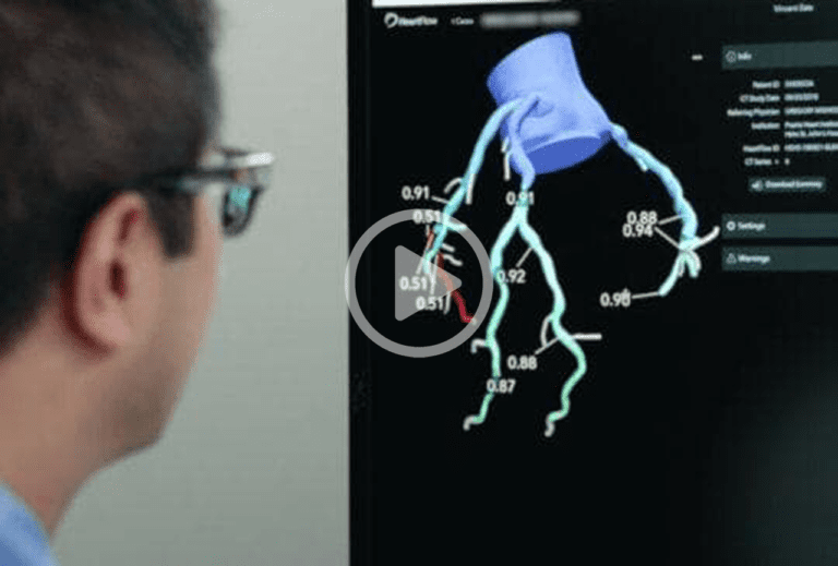 CT+FFRct｜ハートフロー・ジャパン